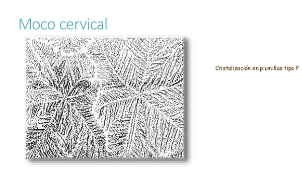 Modelo Creighton - Bioeticawiki
